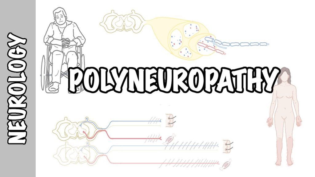 Approach to Polyneuropathy (Causes and Pathophysiology Video)